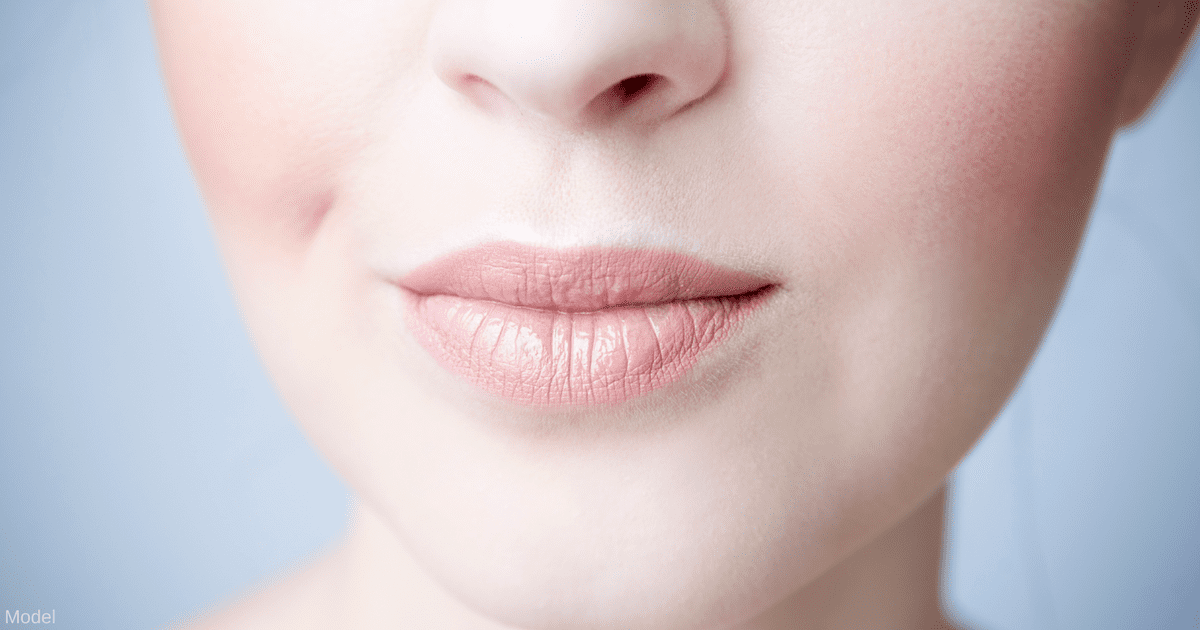 Upper lip lift surgery is Better than injections for a Long Lip